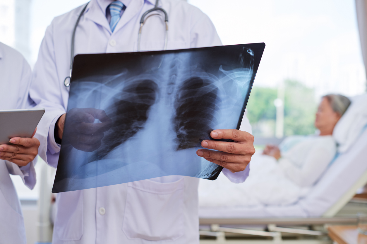 Chest Injuries After a Car Accident in Tampa, FL - Catania and Catania ...
